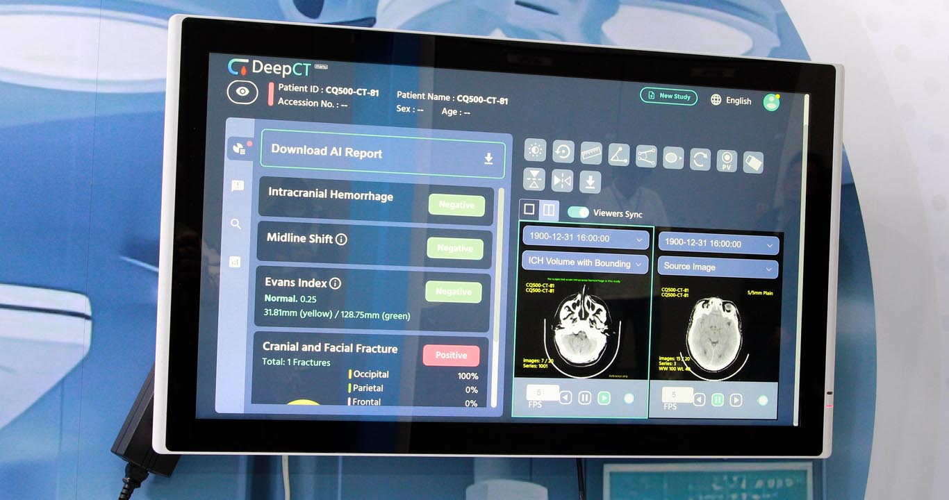 Intel showcases various AI-augmented partner solutions at Healthcare+ ...